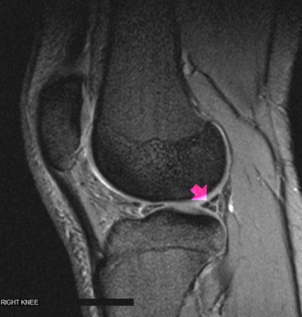 Knee Imaging - Knee & Sports - Orthobullets