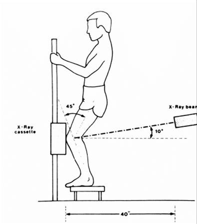 Knee Imaging - Knee & Sports - Orthobullets