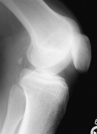 Knee Imaging - Knee & Sports - Orthobullets