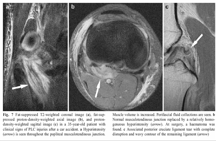 Knee Imaging - Knee & Sports - Orthobullets