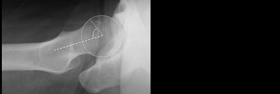 Question 5882 - Qbank - Orthobullets