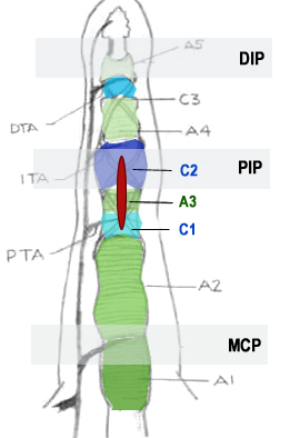 Phalanx Dislocations - Hand - Orthobullets